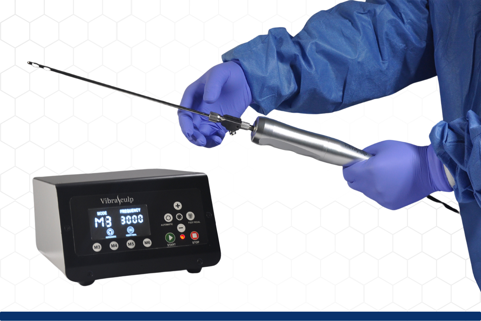 VibraSculp – Power Assisted Lipoplasty Device